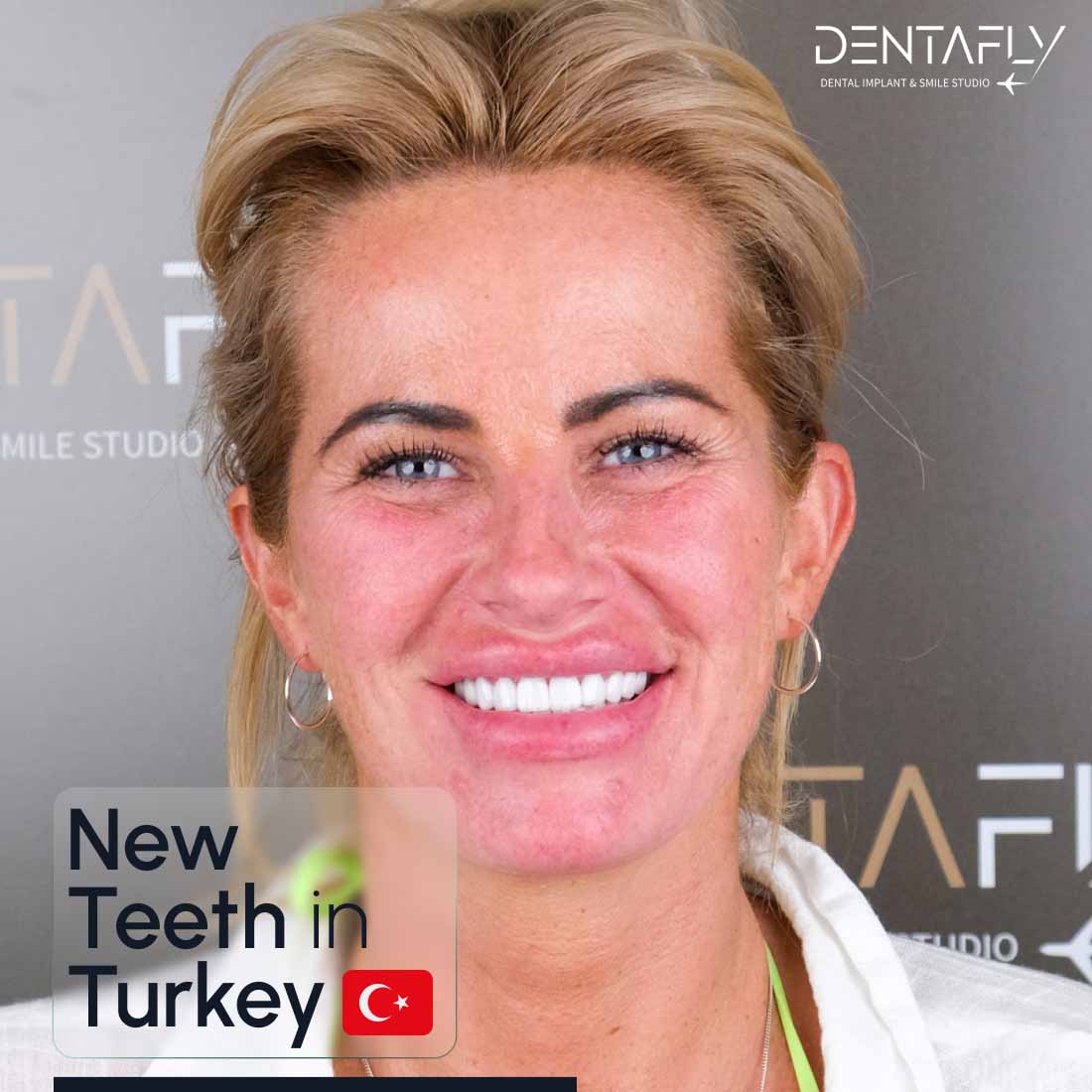 New Teeth in Turkey: Costs, Packages, Procedure 2023