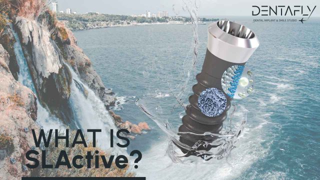 Straumann Implant Prices in Turkey - Costs Features