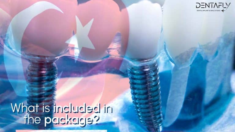 Full Mouth Dental Implants in Turkey: Full Guide for Everyone