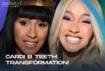 Celebrity Teeth: Incredible Transformations of 20 Stars