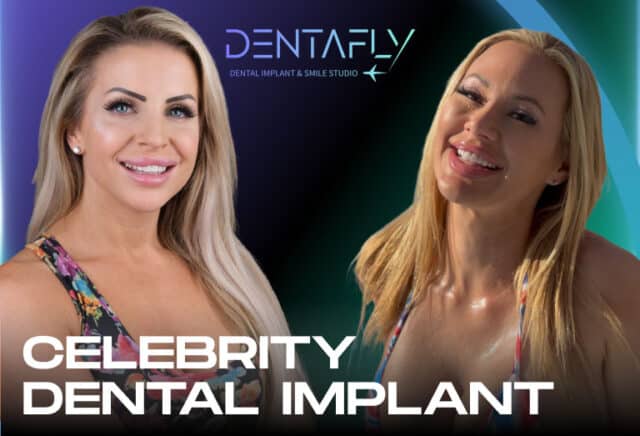 Celebrity Teeth: Incredible Transformations of 20 Stars