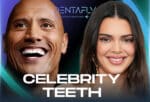 Celebrity Teeth: Incredible Transformations of 20 Stars