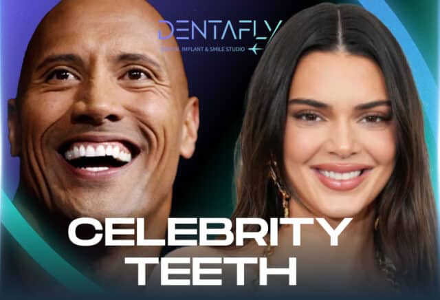Celebrity Teeth: Incredible Transformations of 20 Stars