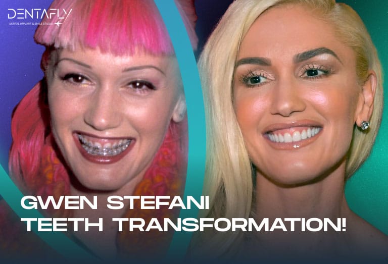 Celebrity Teeth: Incredible Transformations of 20 Stars