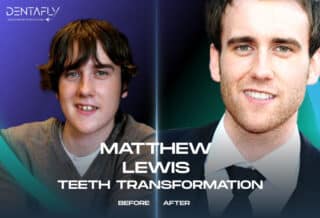 Celebrity Teeth: Incredible Transformations of 20 Stars