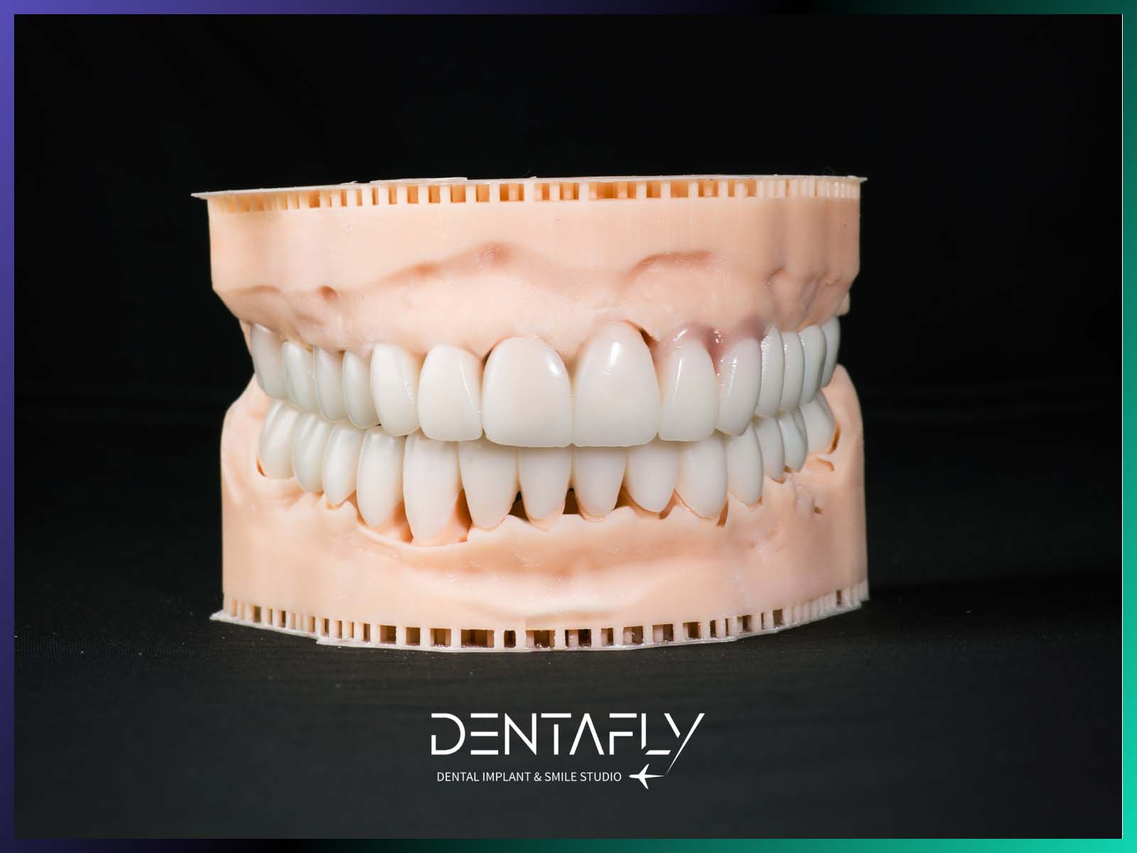 Full set of teeth Turkey cost - Dentafly Dental Clinic - Denta Fly