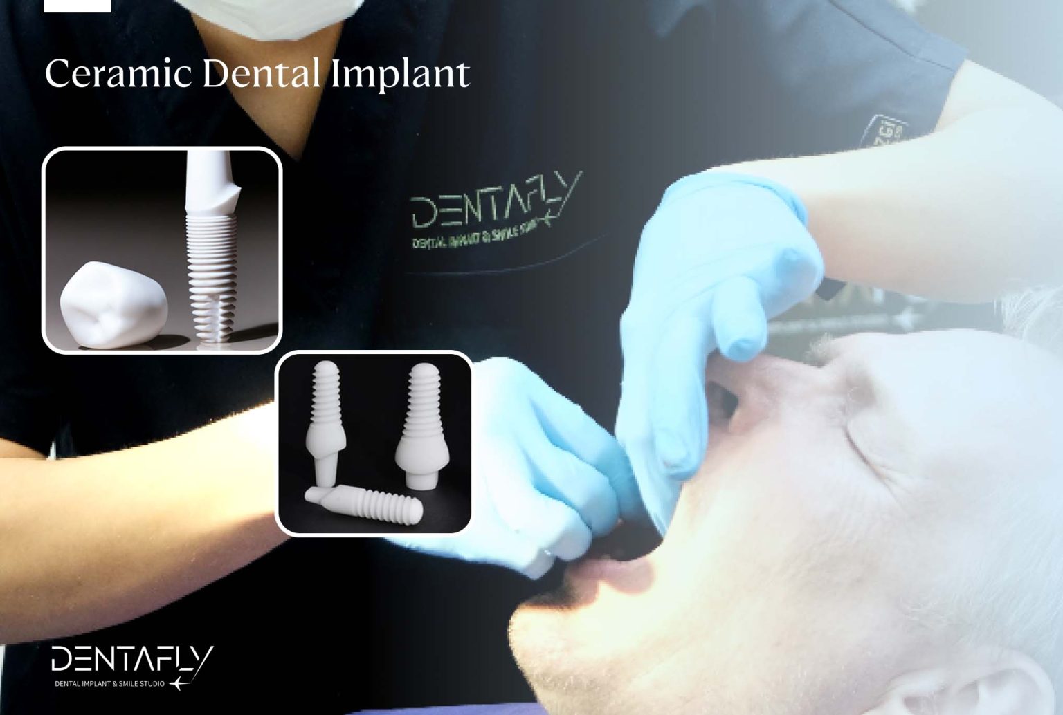Ceramic Dental Implants Turkey: Aesthetic Oral Rehabilitation