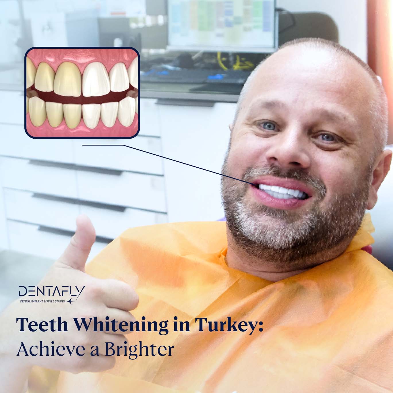 Teeth Whitening in Turkey: Affordable Brighter Smile Options