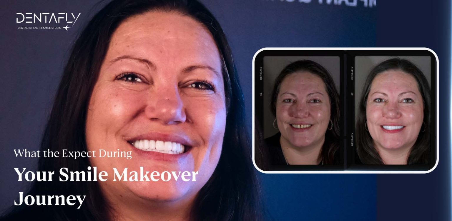 What to Expect on a Smile Makeover Journey: Step-by-Step