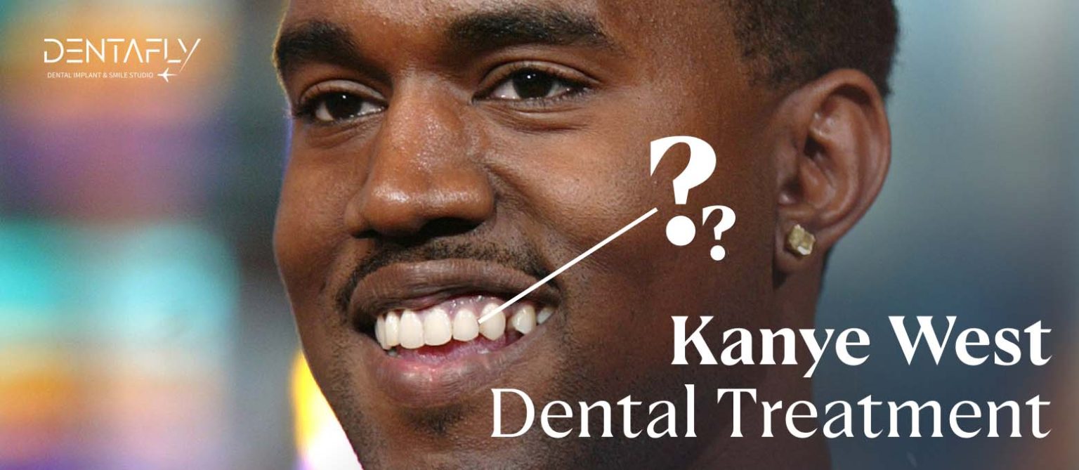 Kanye West Teeth: $850K Titanium Transformation Story