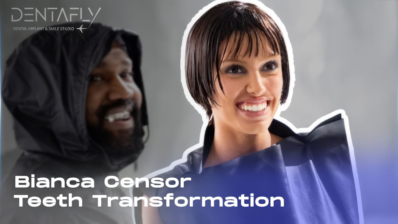 Bianca Censori’s Teeth: Signature Smile - The Definitive 2025 Profile ...