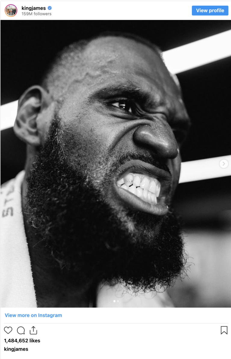 LeBron James Teeth Before & After: Smile Transformation